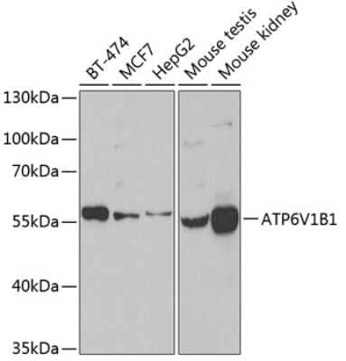 ATP6V1B1 Antibody (NBP2-92479): Novus Biologicals