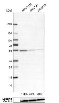 ATPB Antibody (NBP1-90816): Novus Biologicals