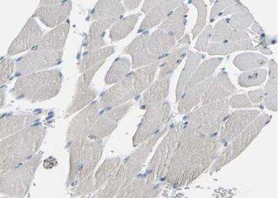 ATPase Na+/K+ beta 2 Antibody (NBP1-90174): Novus Biologicals