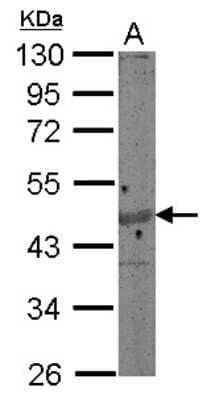 Actin Gamma 1 Antibody (NBP2-15258): Novus Biologicals
