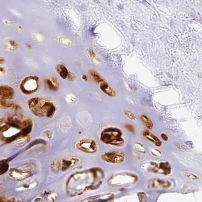 Aggrecan Antibody (NBP2-55539): Novus Biologicals