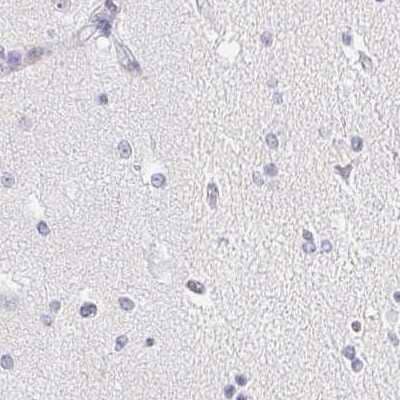 Aggrecan Antibodies: Novus Biologicals
