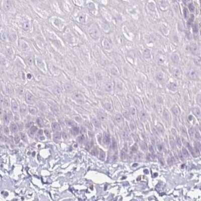 Aggrecan Antibodies: Novus Biologicals
