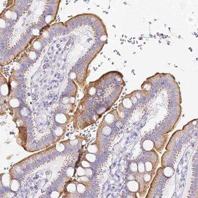Alkaline Phosphatase, Intestinal Antibody (NBP2-34057): Novus Biologicals