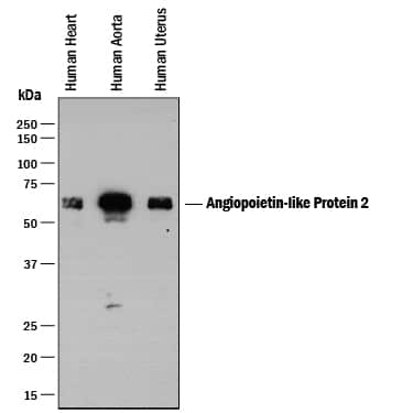 Angiopoietin-like Protein 2/ANGPTL2 Antibody [Unconjugated] (AF2084 ...