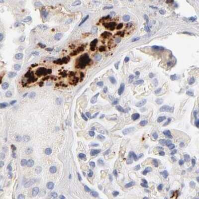 Apolipoprotein H/ApoH Antibodies: Novus Biologicals