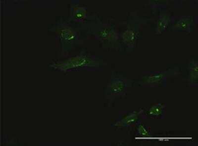 B3GALT6 Antibody (H00126792-B01P-50ug): Novus Biologicals