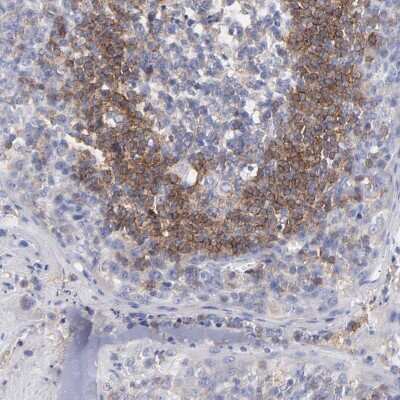 BAFFR/TNFRSF13C Antibody (NBP1-90011): Novus Biologicals