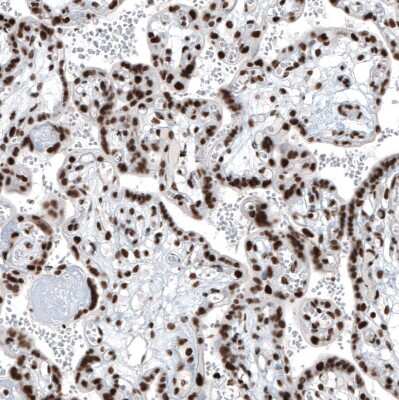BRD4 Antibody (NBP1-86640): Novus Biologicals