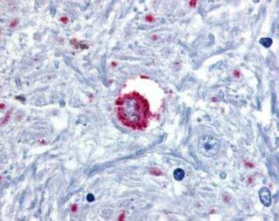 BRS3 Antibody (NBP1-02353): Novus Biologicals