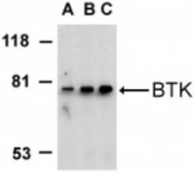 BTK Antibodies: Novus Biologicals