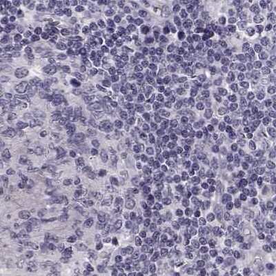 Basalin Antibody (NBP2-56332): Novus Biologicals