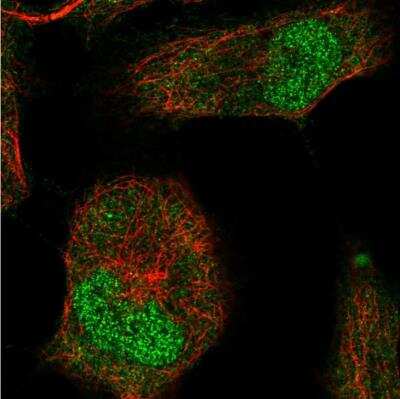 Brachyury Antibody (NBP1-87598): Novus Biologicals