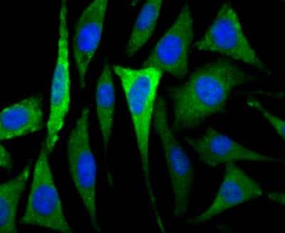 CACNG1 Antibody [Alexa Fluor® 488] (NBP2-99567AF488): Novus Biologicals