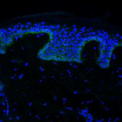 CCL7/MCP-3/MARC Antibodies: Novus Biologicals