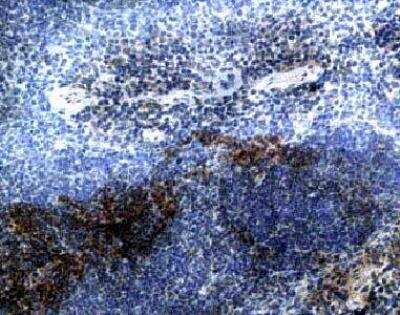 CCR7 Antibody (NB100-712): Novus Biologicals