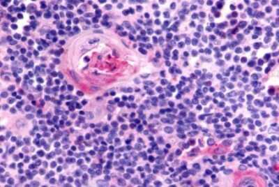 CCR7 Antibodies: Novus Biologicals