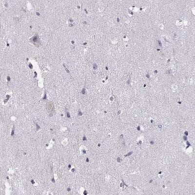 CCR8 Antibody (NBP2-68645): Novus Biologicals