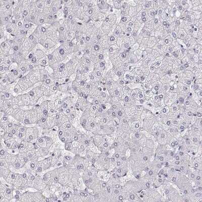 CCR8 Antibody (NBP2-68645): Novus Biologicals