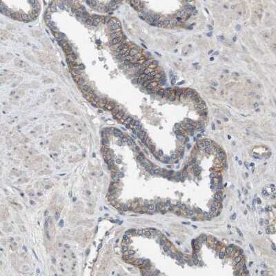 CD155/PVR Antibody (NBP1-88131): Novus Biologicals