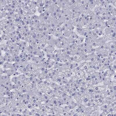 CD1a Antibody (NBP1-86560): Novus Biologicals
