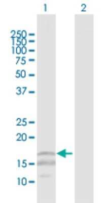 CD3 zeta Antibody (H00000919-D01P): Novus Biologicals