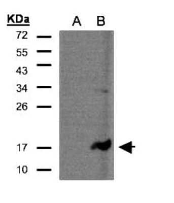 CD3 zeta Antibody (NBP2-15796): Novus Biologicals