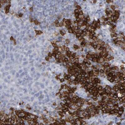 CD38 Antibody (NBP1-86010): Novus Biologicals