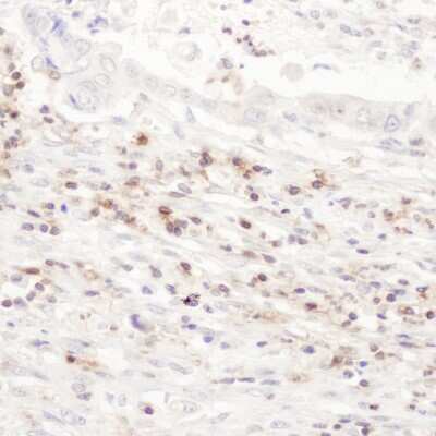 CD43/Sialophorin Antibody (NBP2-32115): Novus Biologicals
