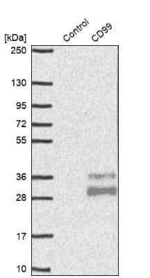 CD99 Antibodies: Novus Biologicals