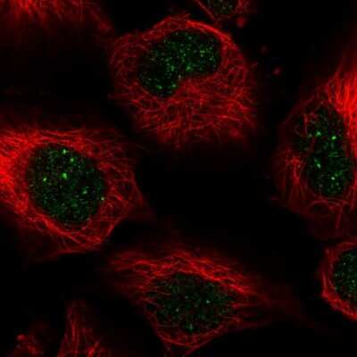 CENPB Antibody (NBP2-55433): Novus Biologicals