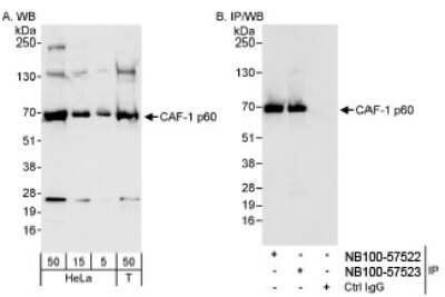 CHAF1B Antibody (NB100-57523): Novus Biologicals