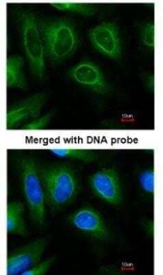 CHIP/STUB1 Antibody (NBP1-30936): Novus Biologicals