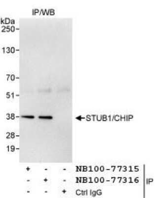 CHIP/STUB1 Antibody (NB100-77316): Novus Biologicals