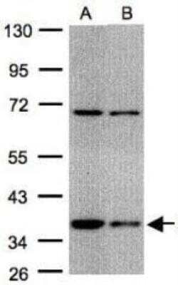 CHIP/STUB1 Antibody (NBP1-30936): Novus Biologicals