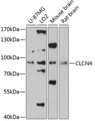 CLCN4 Antibody (NBP2-92128): Novus Biologicals