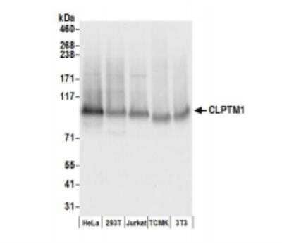 CLPTM1L Antibody [HRP] (NBP2-99271H): Novus Biologicals