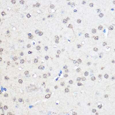 CNOT7 Antibody (NBP2-92571): Novus Biologicals