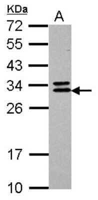 CNOT7 Antibody (NBP2-15929): Novus Biologicals