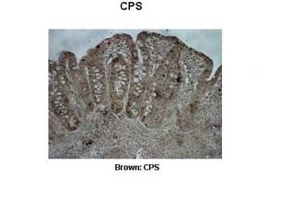 CPS1 Antibody (NBP1-54775): Novus Biologicals
