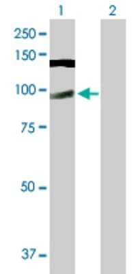 CWC22 Antibody (H00057703-B01P): Novus Biologicals