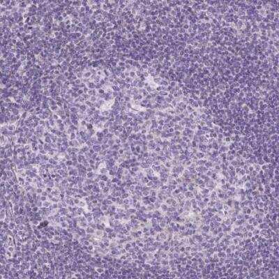 CXCL4/PF4 Antibody (NBP2-46804): Novus Biologicals