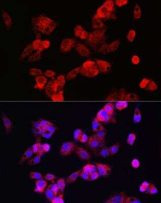 CYP7A1 Antibody - Azide and BSA Free (NBP3-04836): Novus Biologicals