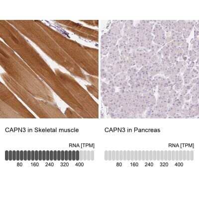 Calpain 3 Antibody (NBP2-34061): Novus Biologicals