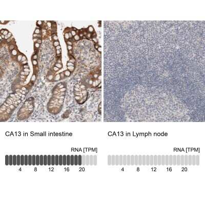 Carbonic Anhydrase XIII/CA13 Antibody (NBP1-86606): Novus Biologicals