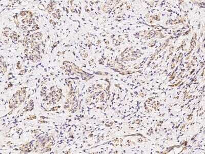 Caveolin-2 Antibody (NBP2-98731): Novus Biologicals