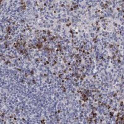 Chitotriosidase/CHIT1 Antibody (NBP3-17651): Novus Biologicals
