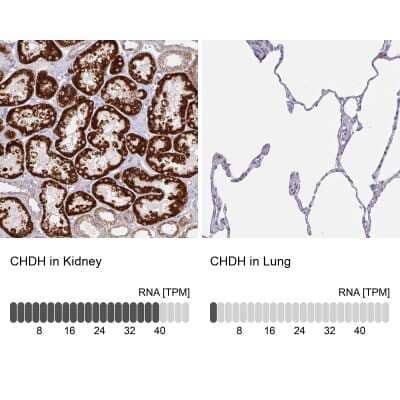 Choline dehydrogenase Antibody (NBP2-38842): Novus Biologicals