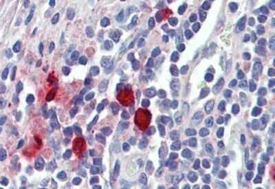 Chymase/CMA1/Mast Cell Chymase Antibody (NBP1-52386): Novus Biologicals