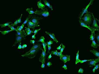 Clathrin light chain Antibody (NBP2-97249): Novus Biologicals